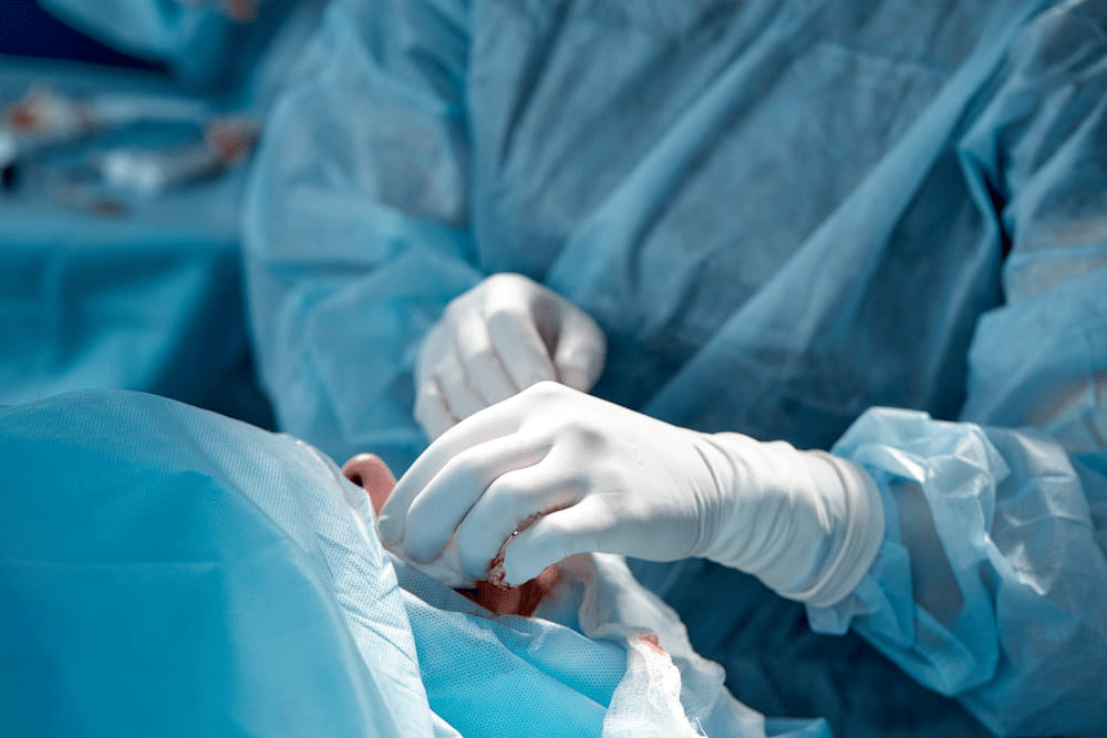 ¿En que consiste la operación de párpados? - Clínica Estética CEMEQ